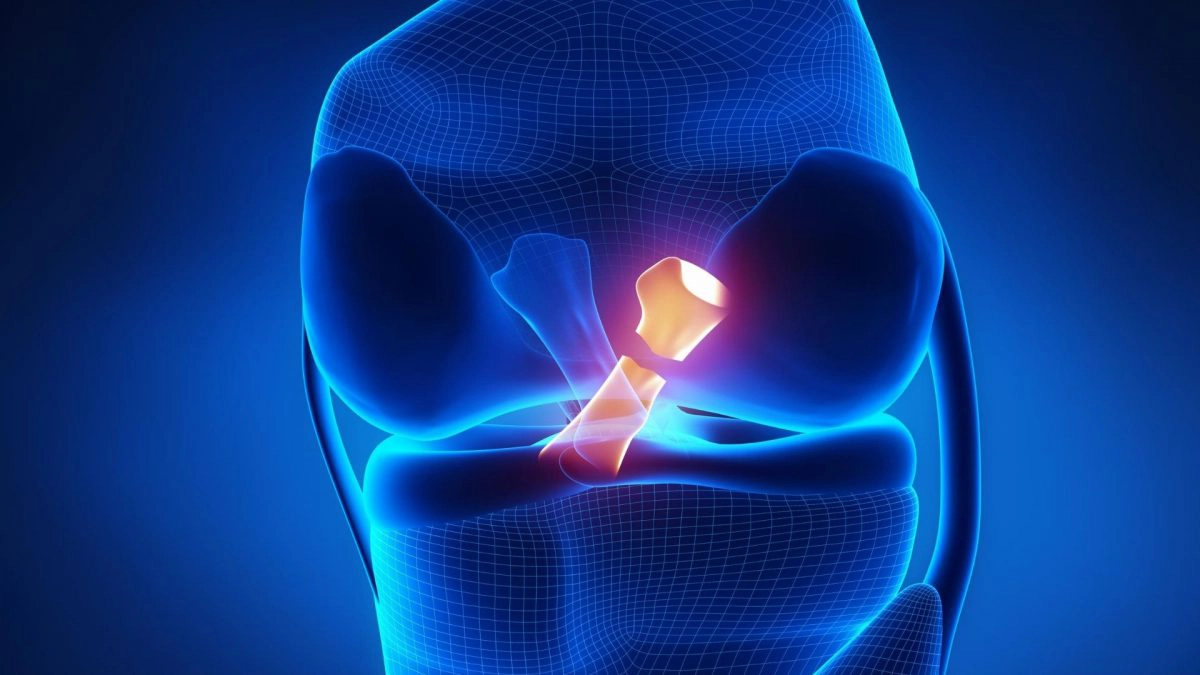 Legamento crociato anteriore rotto: quali test? - FisioScience