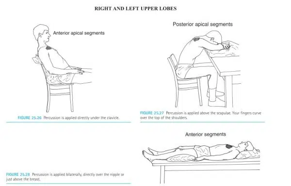 Drenaggio posturale: cosa serve e come si fa? - FisioScience