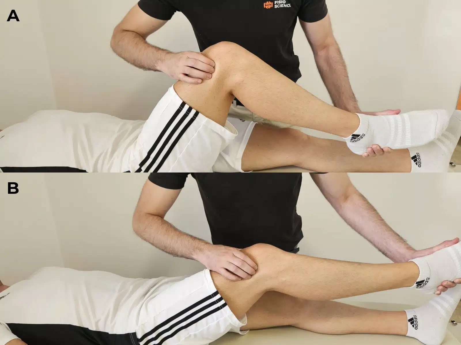 Sindrome della bandelletta ileotibiale - FisioScience