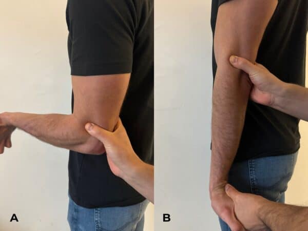 Epitrocleite - dolore mediale di gomito - FisioScience