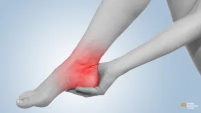 Sindrome del tunnel tarsale - FisioScience