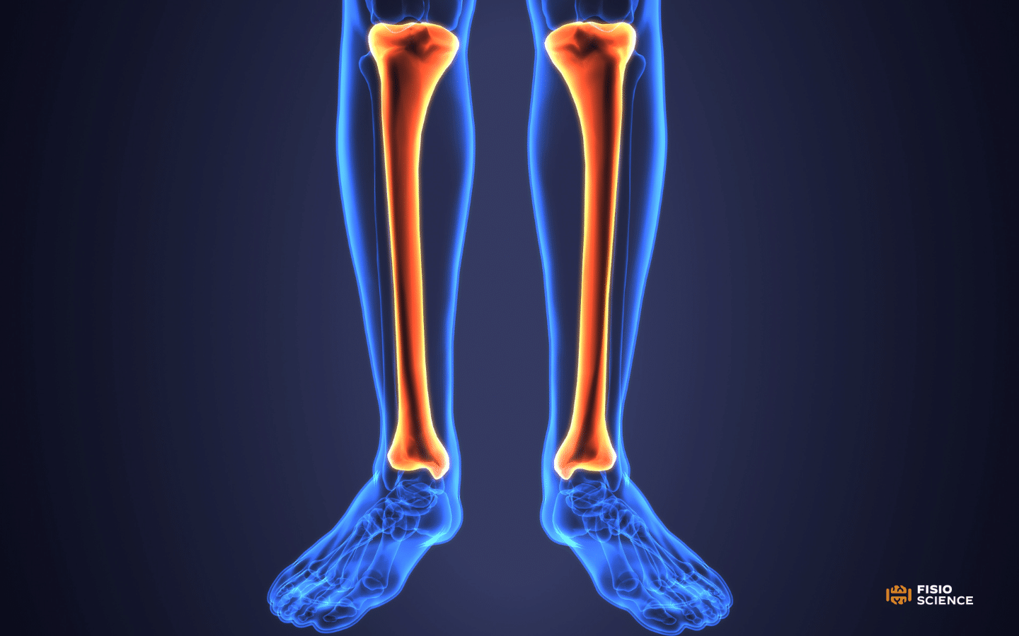 Medial Tibial Stress Syndrome (MTSS) - FisioScience