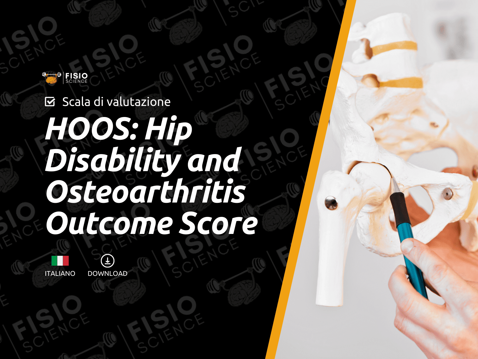HOOS: Hip Disability and Osteoarthritis Outcome Score - FisioScience