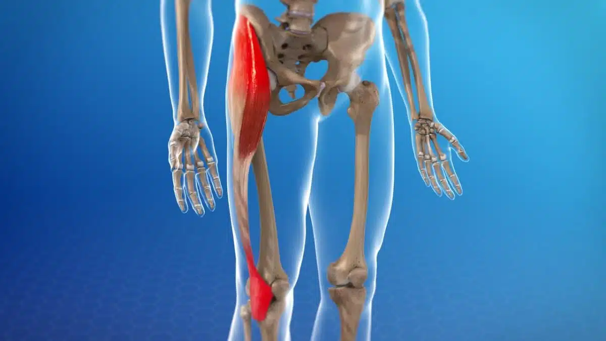 Sindrome della bandelletta ileotibiale - FisioScience