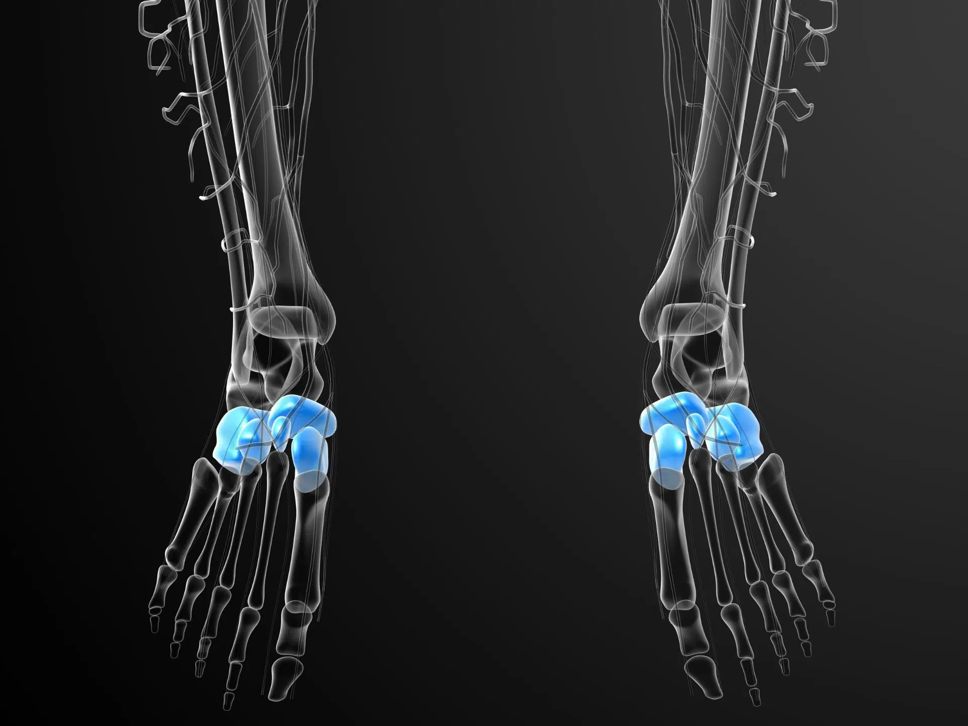 Sindrome del cuboide - FisioScience