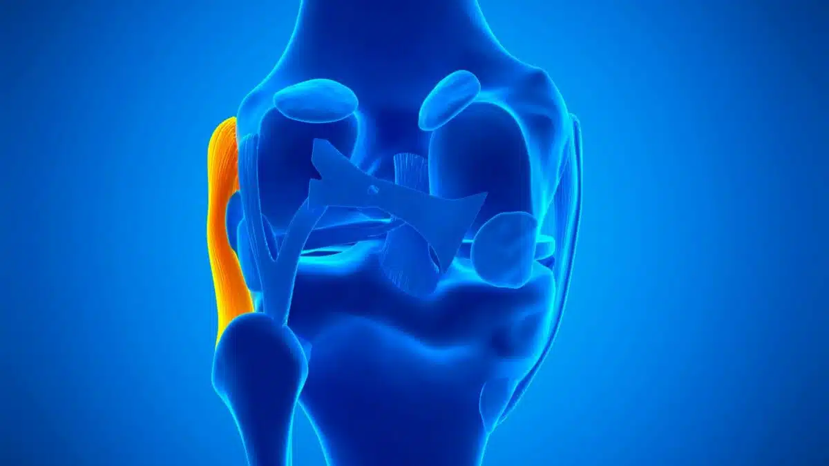 Lesione del legamento collaterale laterale - FisioScience