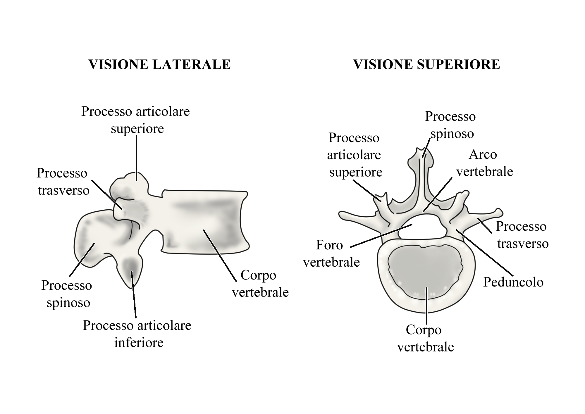 Spondilolisi - FisioScience