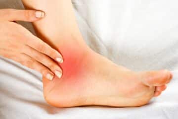 Segno di Wasserman: il Lasegue inverso - FisioScience