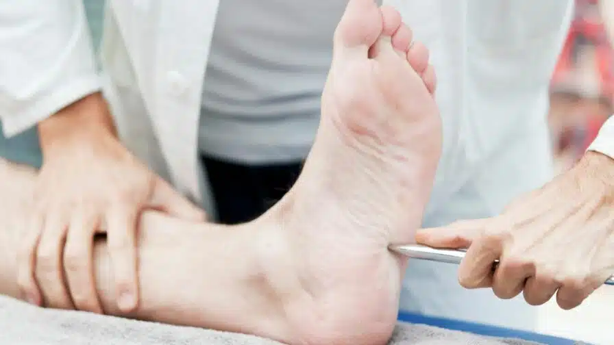 Segno di Babinski - FisioScience