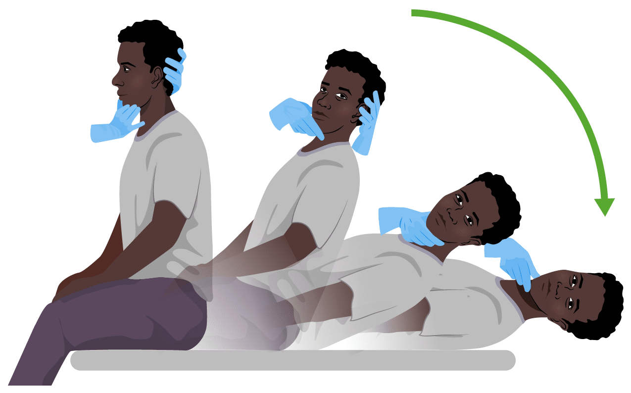 Dix-Hallpike Test - FisioScience
