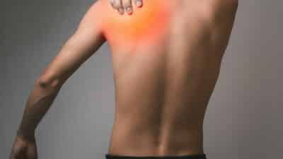 Sindrome di Parsonage-Turner - FisioScience