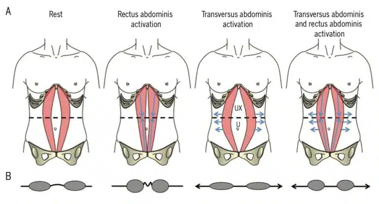 Diastasi addominale - FisioScience