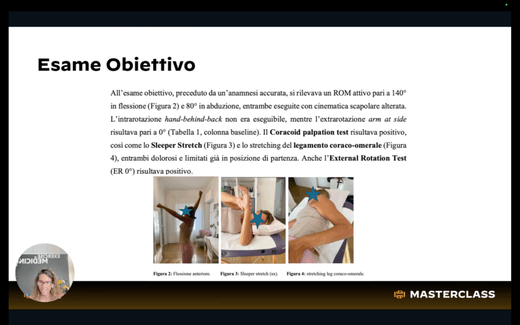 Masterclass Frozen Shoulder - FisioScience